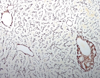 Normal Liver Anatomy and Introduction to Liver Histology | Abdominal Key