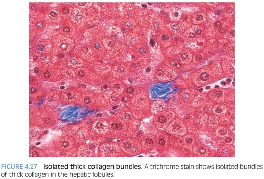 Liver Injury Patterns | Abdominal Key