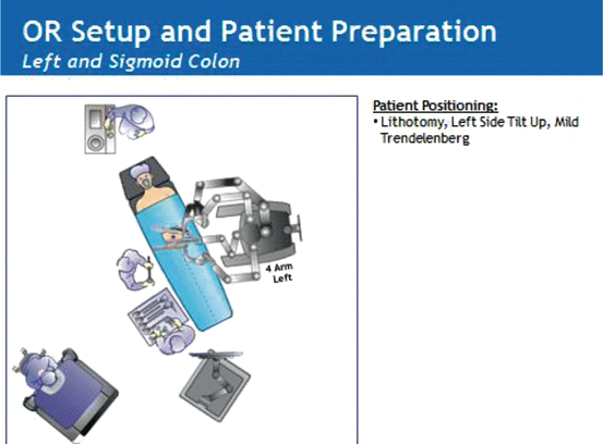 Robotic Total Colectomy | Abdominal Key