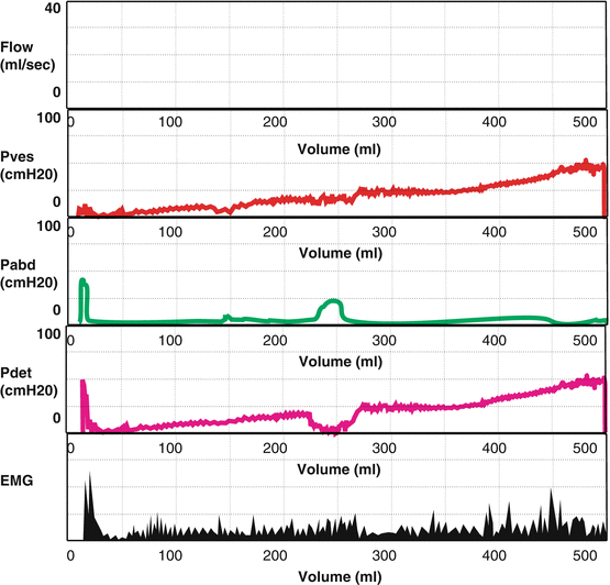 Urodynamics Evaluation Of Underactive Bladder Abdominal Key