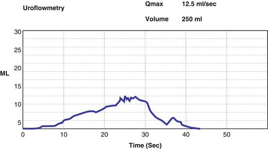 Urodynamics Evaluation Of Underactive Bladder Abdominal Key