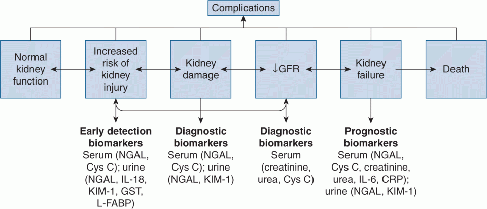 Acute Kidney Injury | Abdominal Key