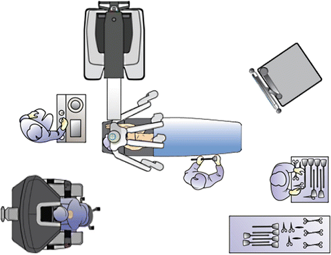 Robotic Lobectomy | Abdominal Key