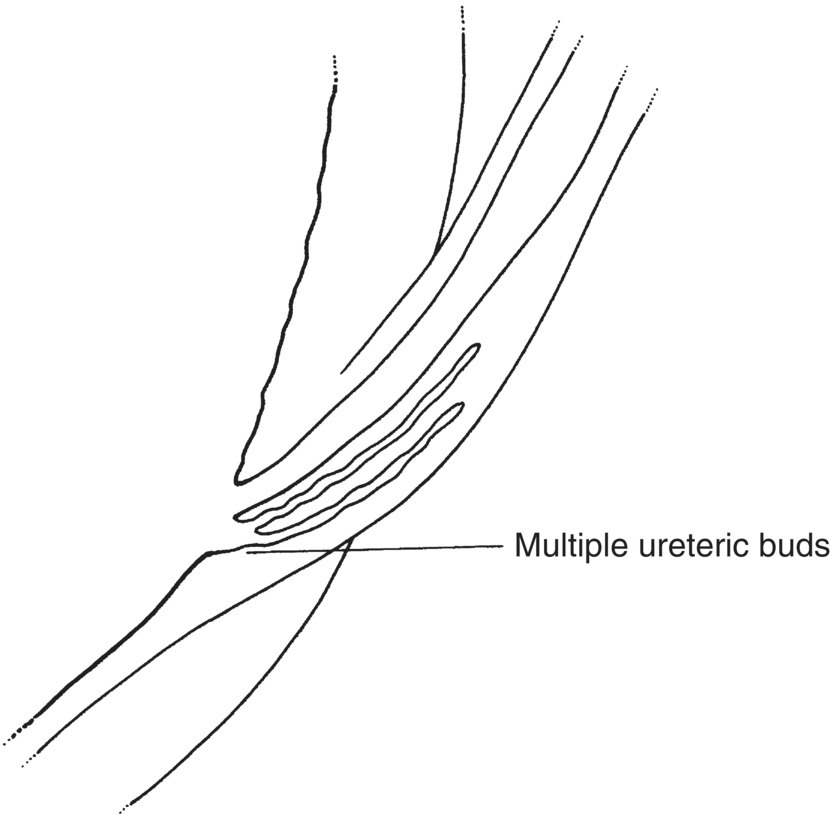 Kidney and Ureter | Abdominal Key