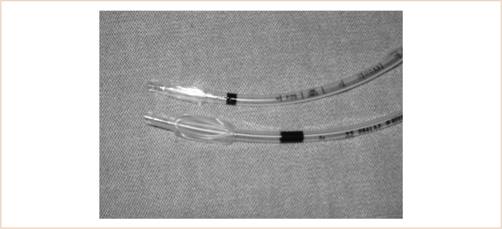 Management of General Anesthesia | Anesthesia Key