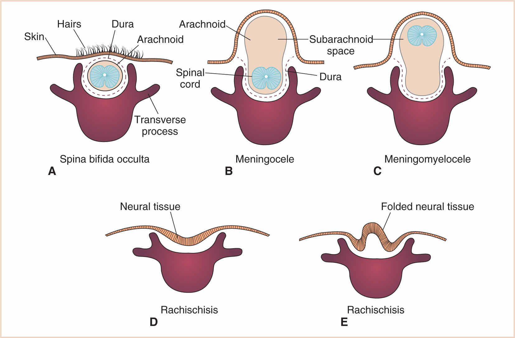 The Central Nervous System: Pediatric Neuroanesthesia | Anesthesia Key