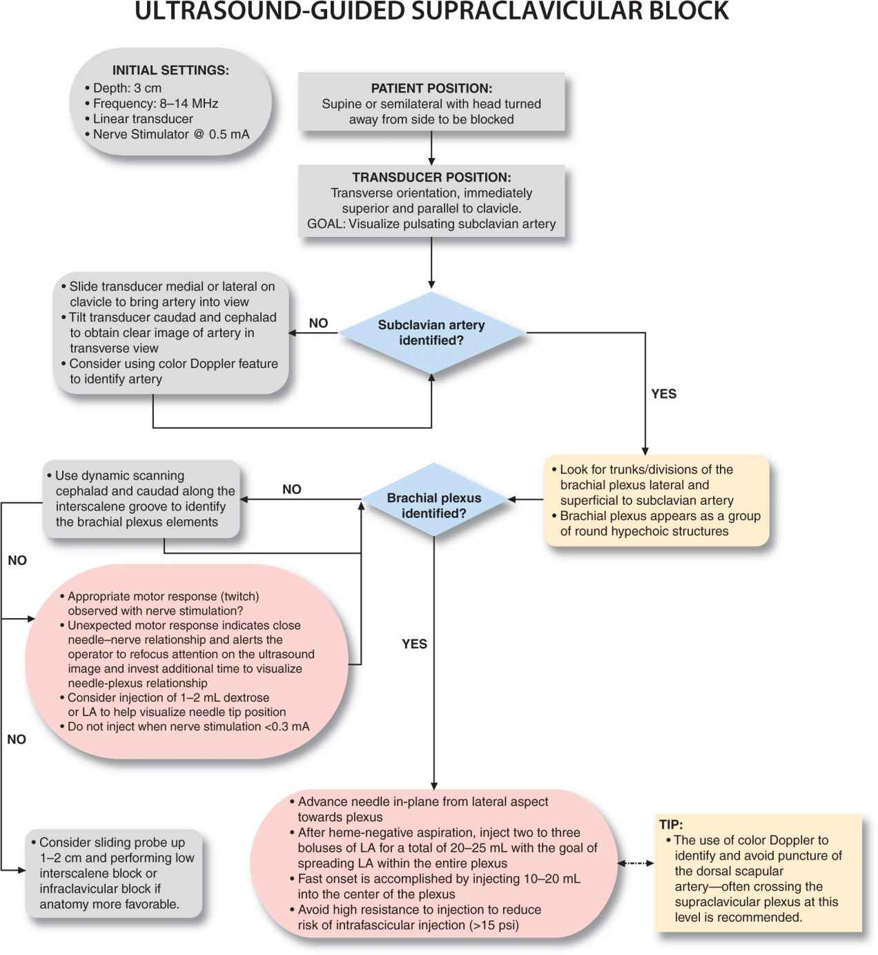 Ultrasound-Guided Supraclavicular Brachial Plexus Block | Anesthesia Key