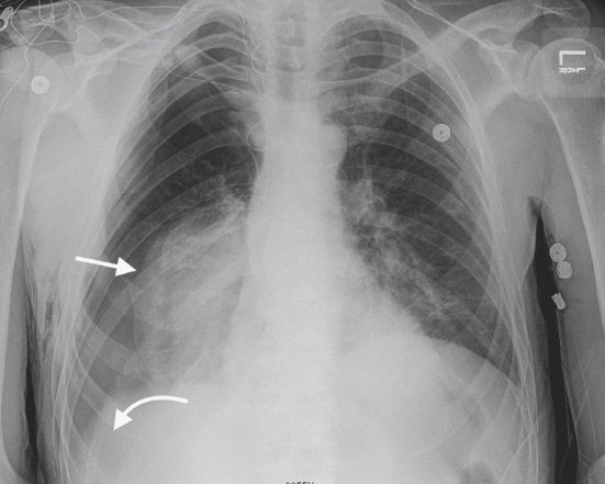 Radiographic Imaging and Bedside Ultrasound | Anesthesia Key