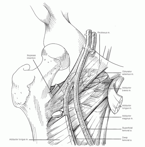 Common Femoral Artery | Basicmedical Key