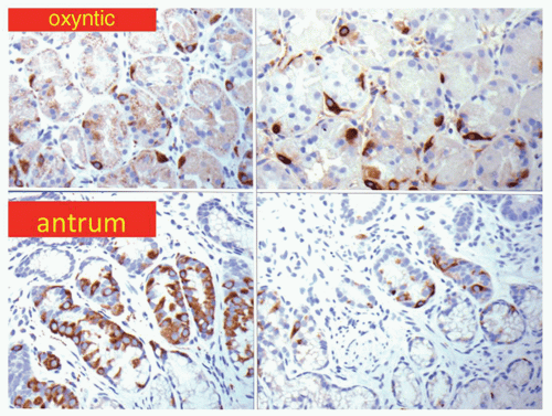 Stomach and Proximal Duodenum: Inflammatory and Miscellaneous Disorders ...