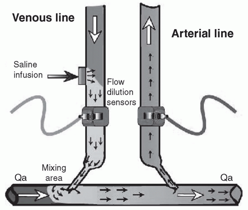 Arteriovenous Vascular Access Monitoring and Complications ...