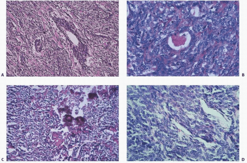 Synovium | Basicmedical Key