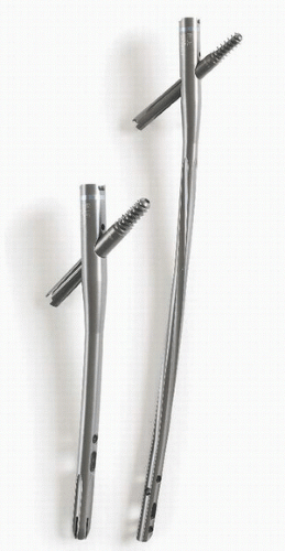 Commonly Performed Orthopaedic Procedures | Basicmedical Key