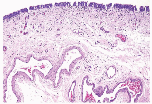 Bladder | Basicmedical Key