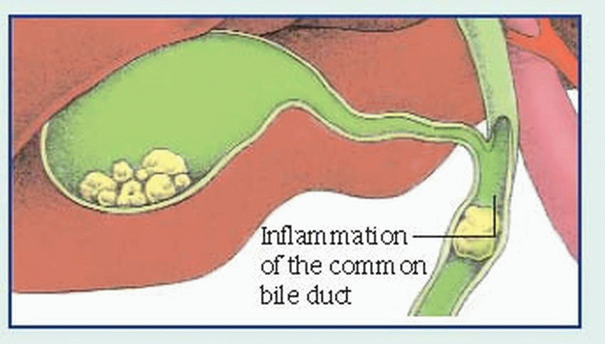 Hepatobiliary Disorders | Basicmedical Key