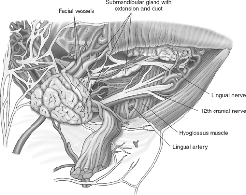Surgery of the Submandibular and Sublingual Salivary Glands ...