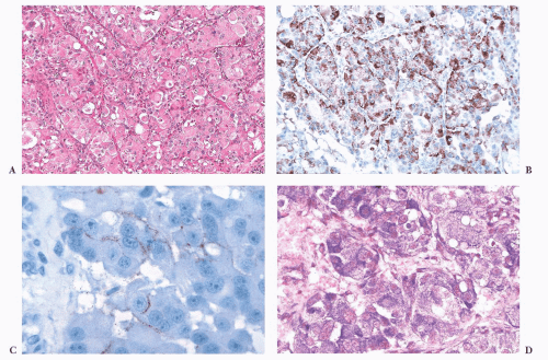 Neuroendocrine and Paracrine Systems | Basicmedical Key