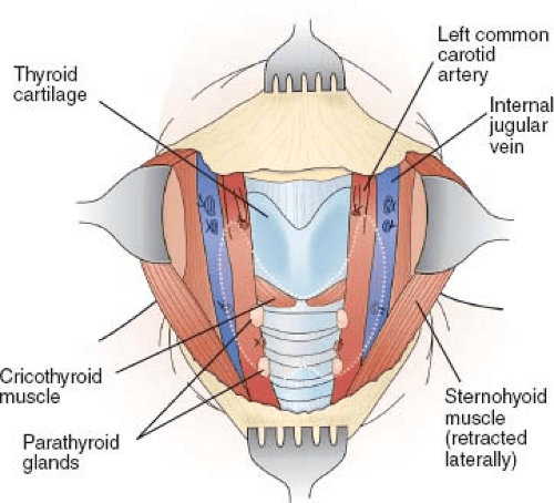 Lymph Node Dissections Of The Neck Basicmedical Key lymph-node-dissections-of-the-neck-basicmedical-key