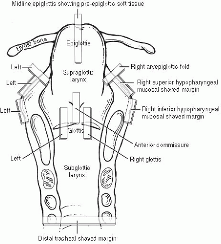 Larynx | Basicmedical Key