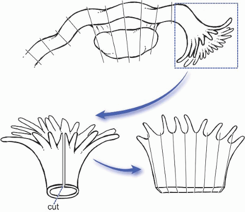 Fallopian Tube | Basicmedical Key
