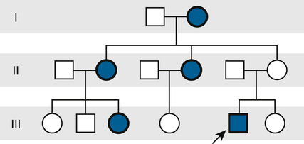 Patterns of Mendelian Inheritance | Basicmedical Key