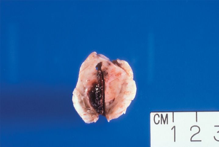 Forensic Pathology | Basicmedical Key