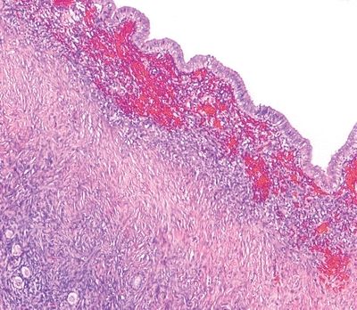 Peritoneum | Basicmedical Key