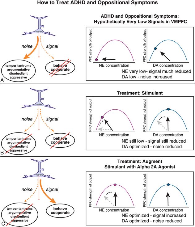 Attention deficit hyperactivity disorder and its treatment ...