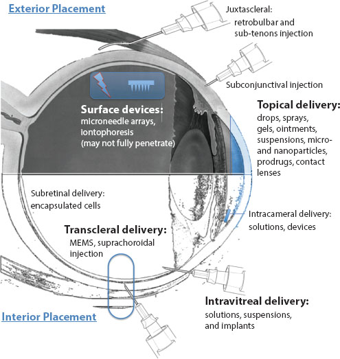 Ophthalmic Drug Delivery | Basicmedical Key