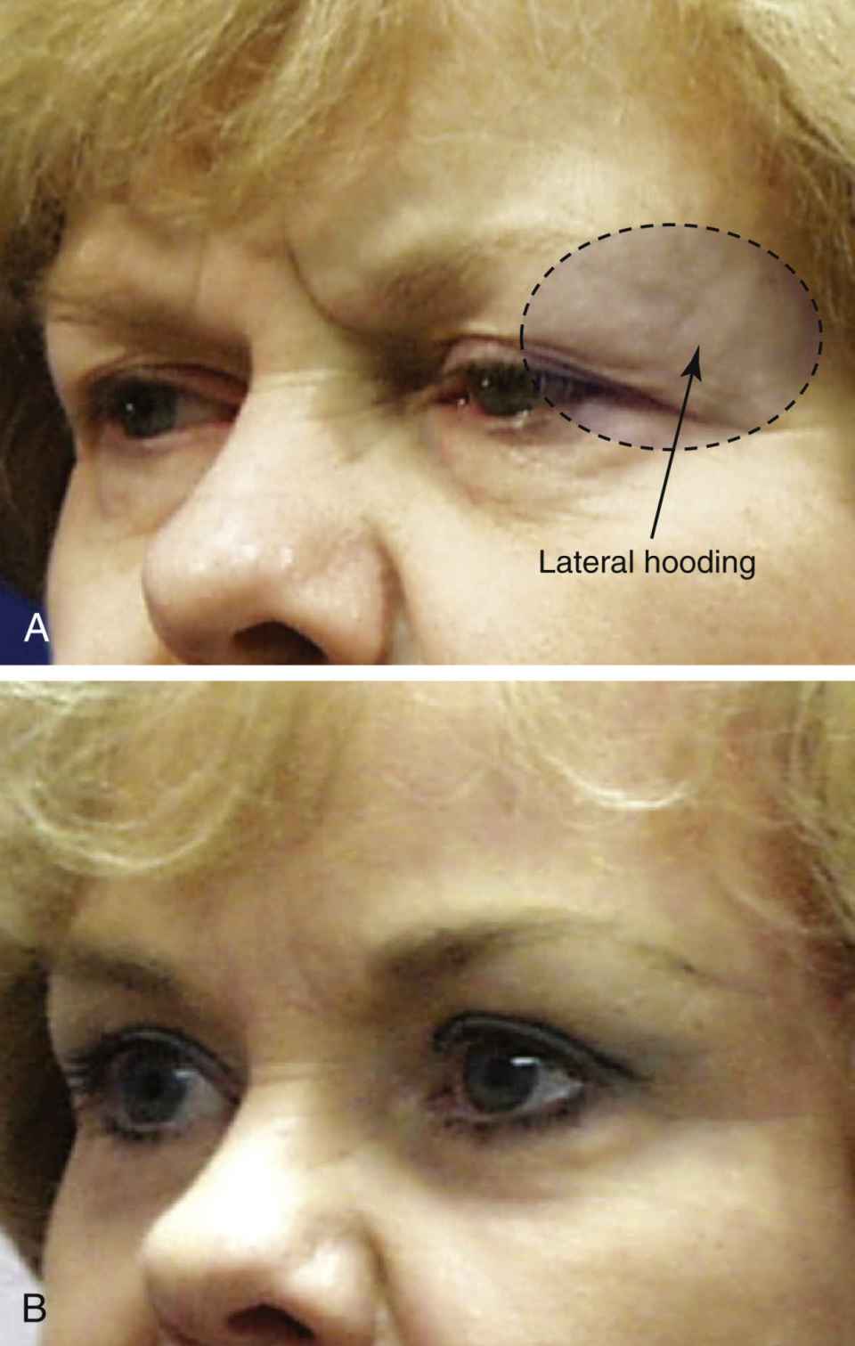 and Reconstructive Surgery | Basicmedical Key