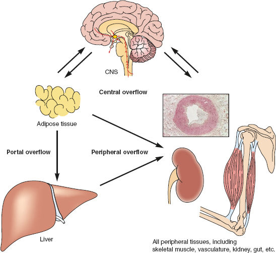 Obesity and Metabolic Disease | Basicmedical Key