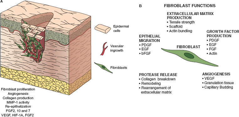 Wound Healing | Basicmedical Key