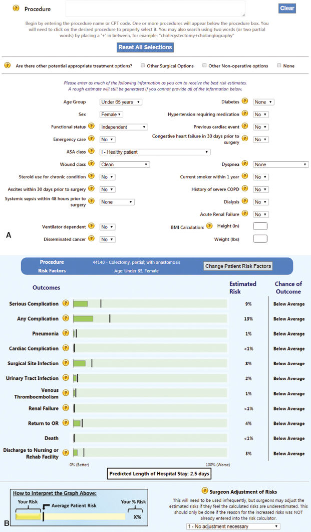 Preoperative Risk Assessment | Basicmedical Key