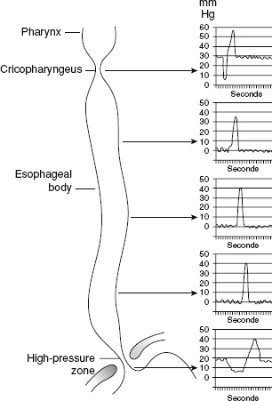 Esophageal Anatomy and Physiology and Gastroesophageal Reflux Disease ...