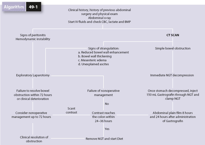 Ileus and Bowel Obstruction | Basicmedical Key