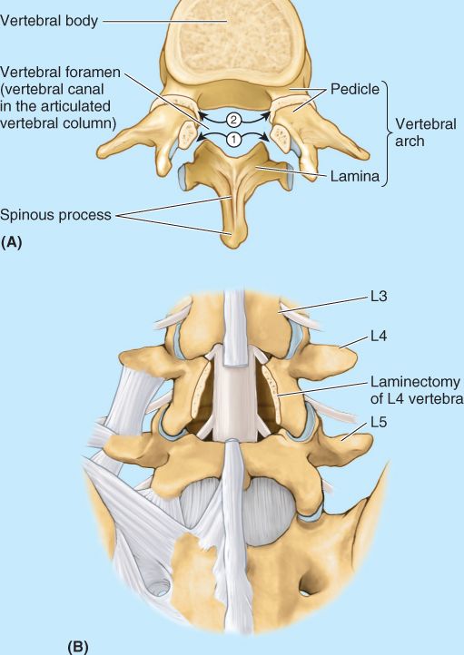 Vertebral Arch