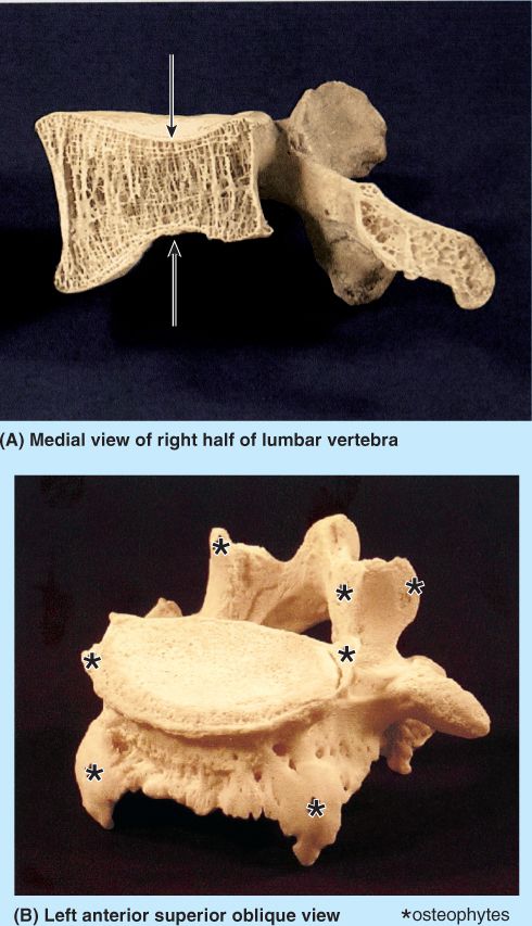 Back | Basicmedical Key