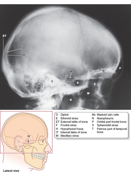 Head | Basicmedical Key