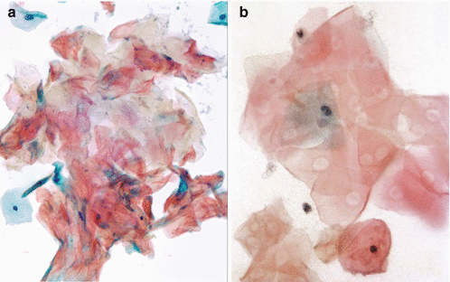 Non-Neoplastic Findings | Basicmedical Key