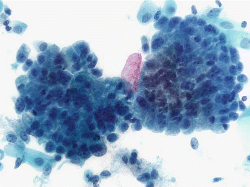 Other Malignant Neoplasms | Basicmedical Key
