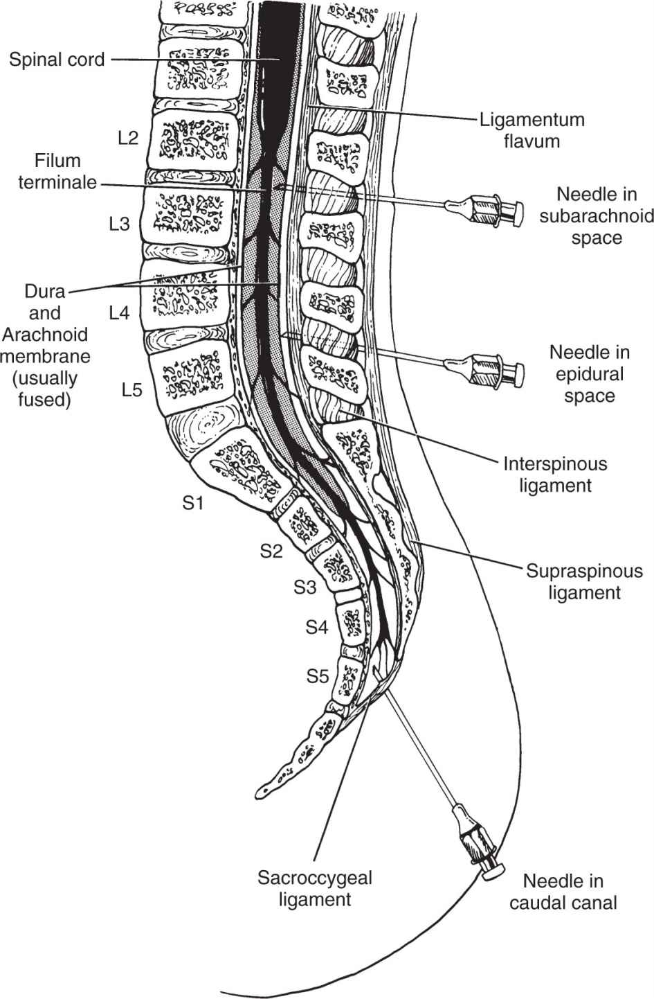Anesthesiology | Basicmedical Key