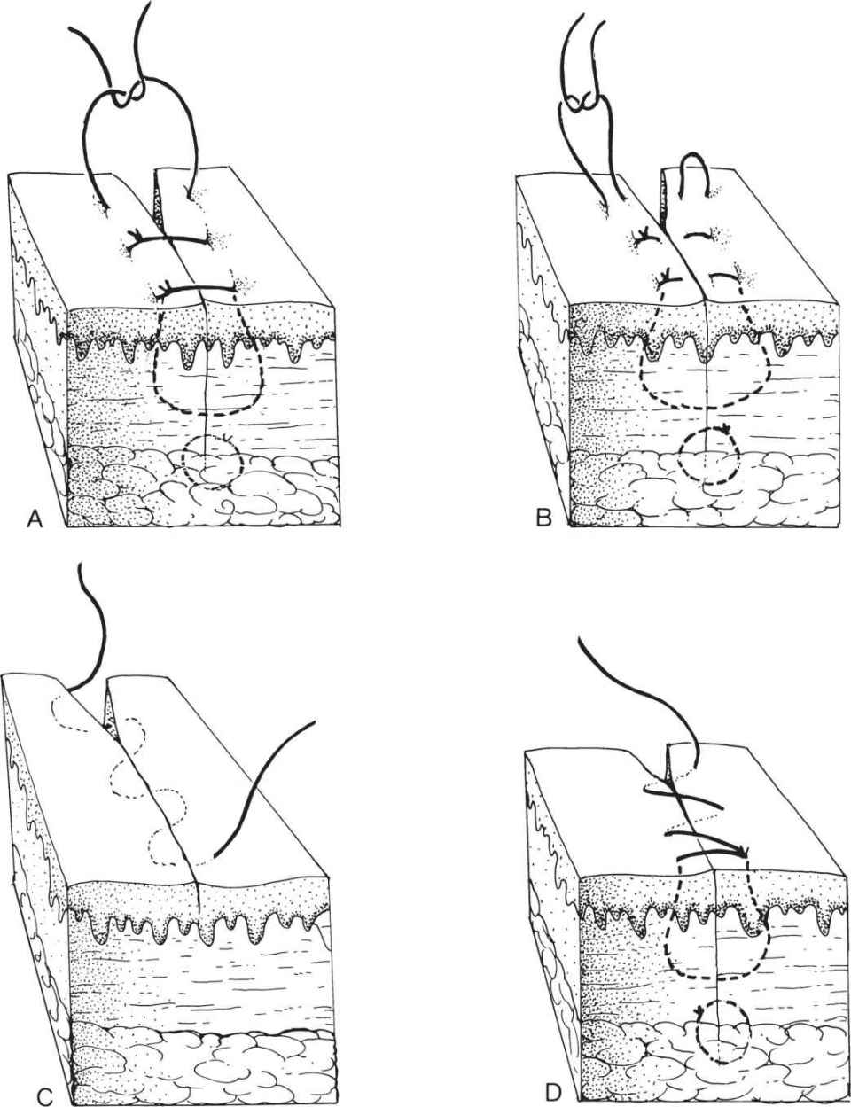 Plastic Surgery: Diseases Of The Skin And Soft Tissue, Face, And Hand ...