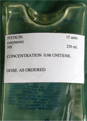 Types of IV Calculations | Basicmedical Key