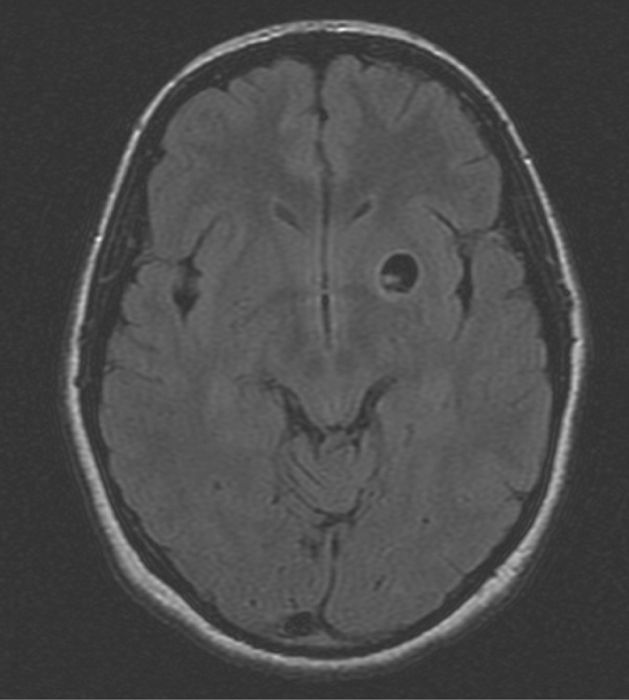 Tropical Infections | Basicmedical Key