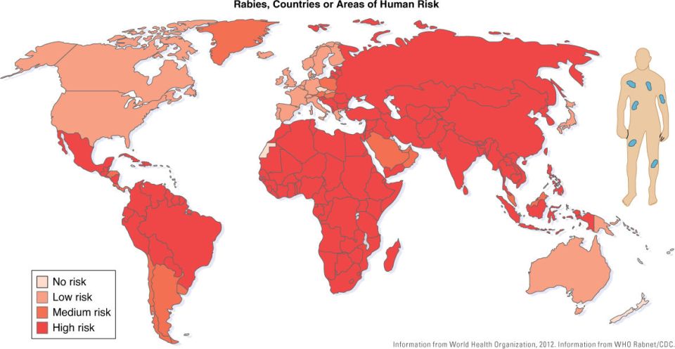 Rabies | Basicmedical Key