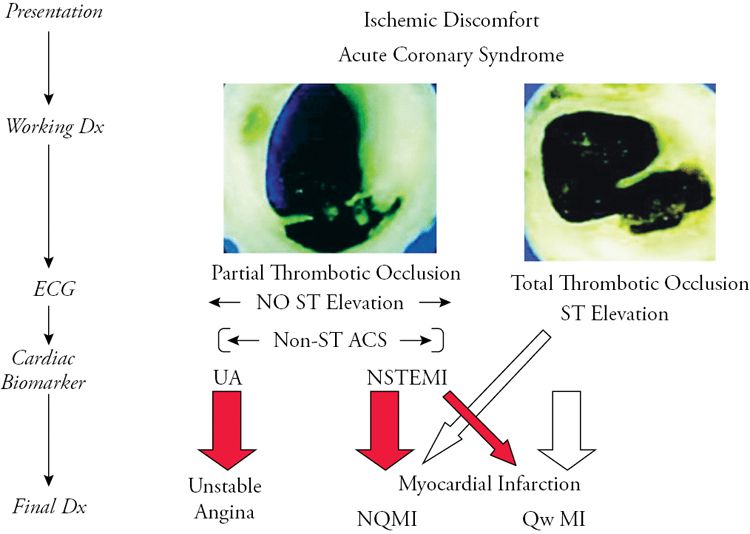 Cardiology Summary | Basicmedical Key