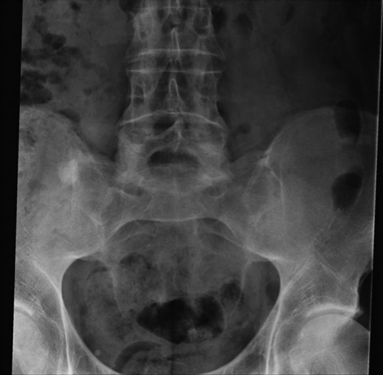 General Internal Medicine Board Review Questions | Basicmedical Key