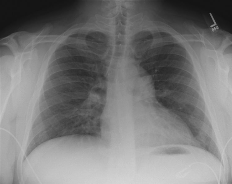 General Internal Medicine Board Review Questions | Basicmedical Key