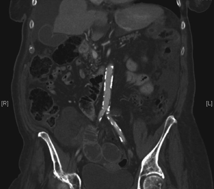 General Internal Medicine Board Review Questions | Basicmedical Key