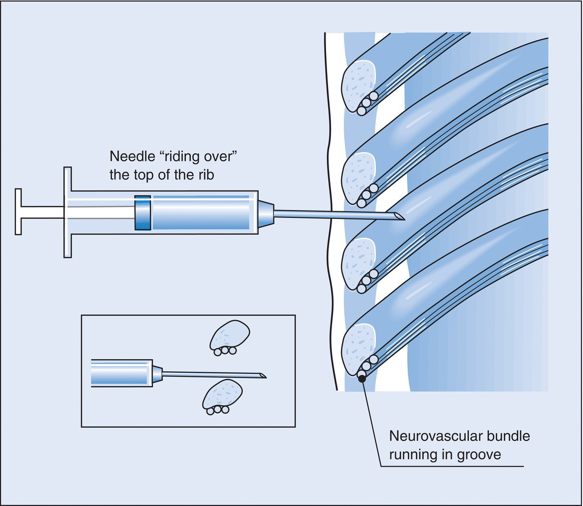 PRACTICAL PROCEDURES | Basicmedical Key